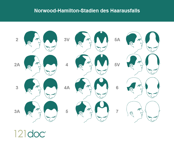 ᐅ Haarausfall Männer: Ursachen, Verlauf & Behandlung